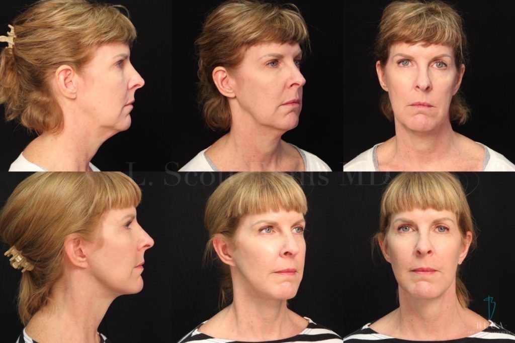 Atlanta Plastic Surgery Center for Breast, Body & Face Enhancements and ...